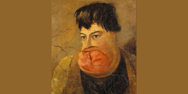 Anatomical Drawing: Disease | Data Thistle